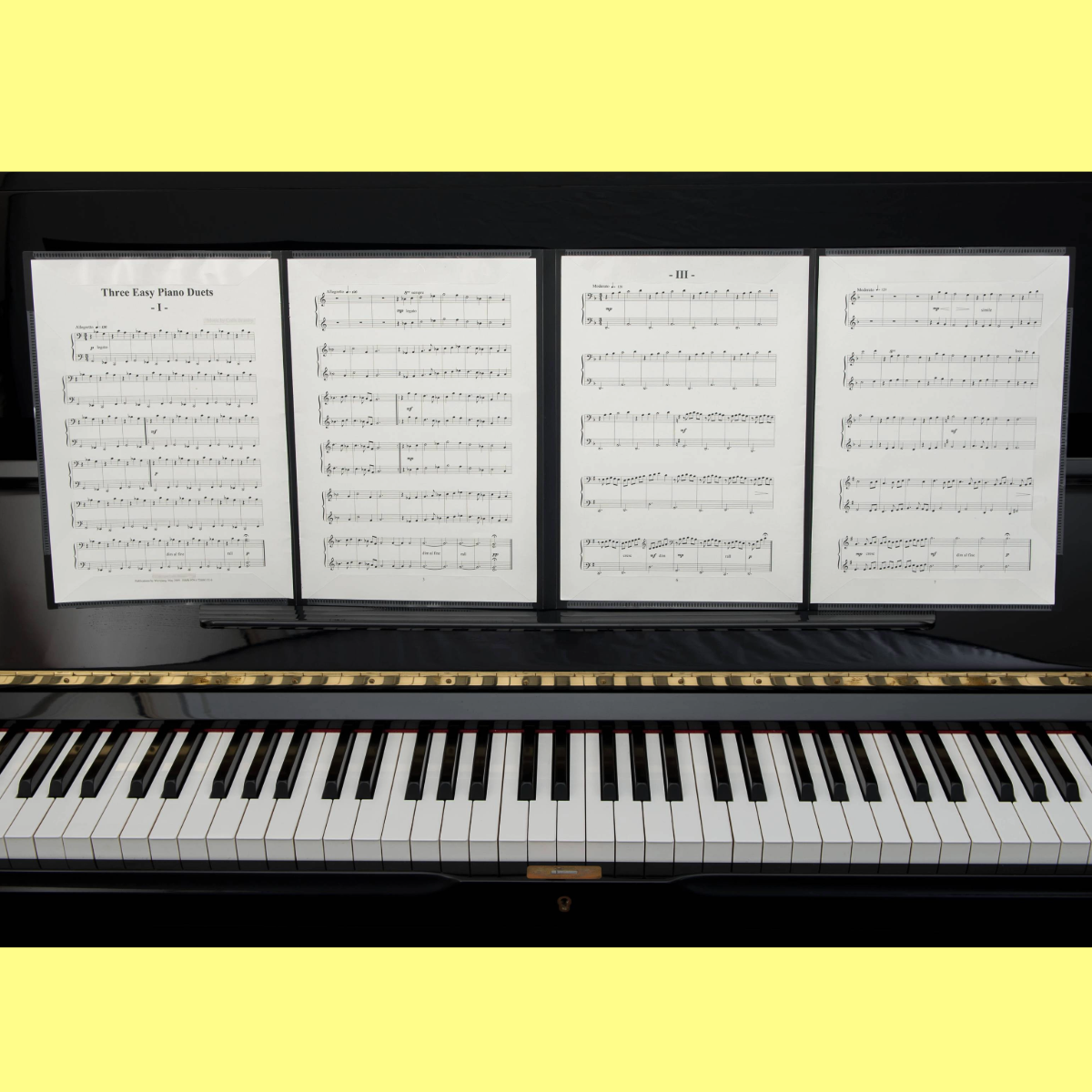 Rondofile Cadenza Concertina Folder (6 x A4 Pages) – Music2u.com.au